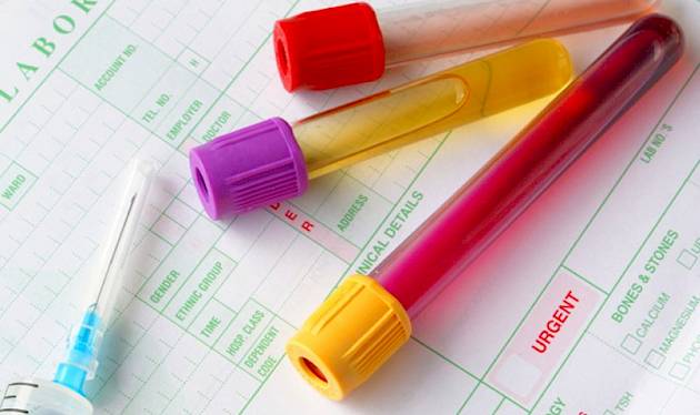 Talasemije - CentarZdravlja