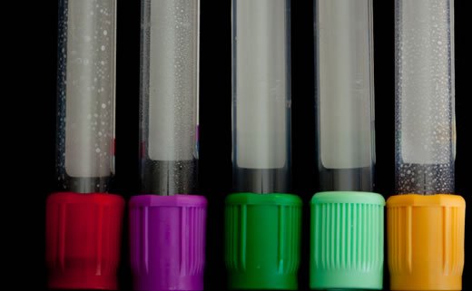 Policitemija rubra vera - CentarZdravlja