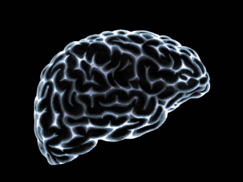 Aneurizma mozga - CentarZdravlja