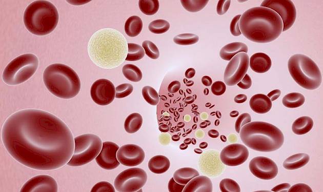 Akutna mijeloična leukemija - CentarZdravlja