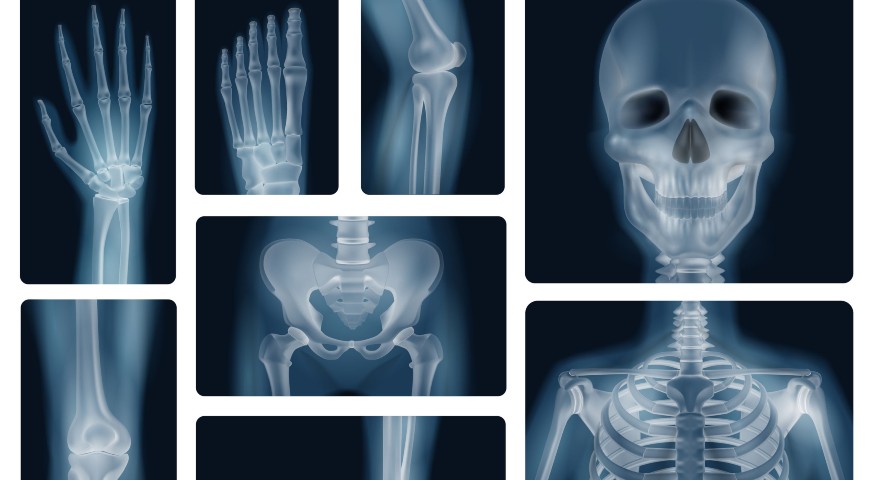 Ovo su fenomenalne činjenice o kostima! - CentarZdravlja