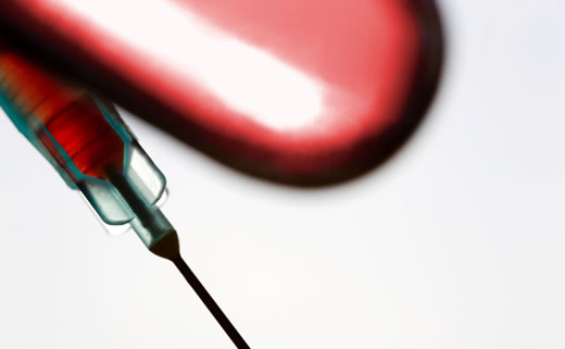 Simptomi zaraze HIV-om - CentarZdravlja