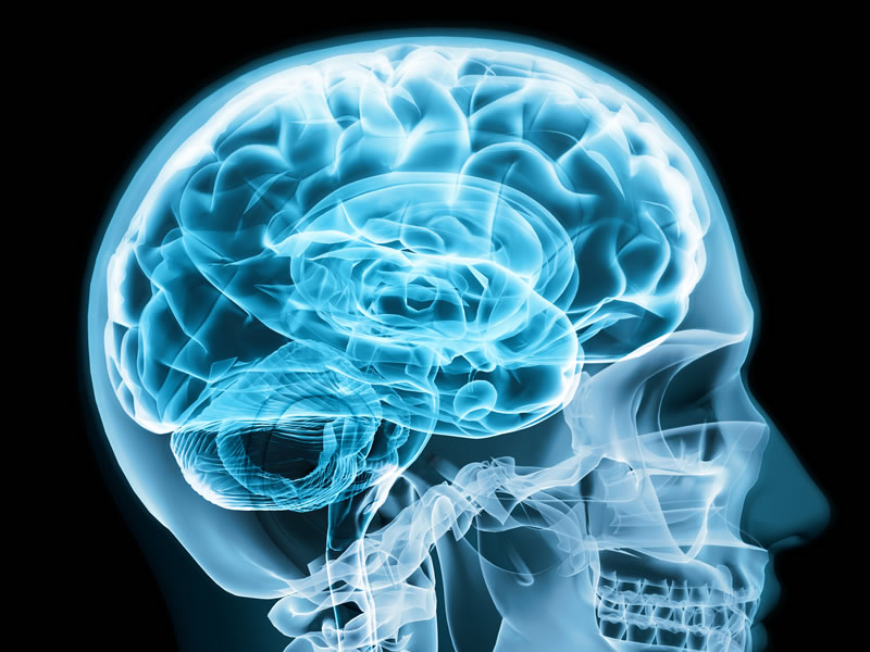 Ovi sastojci truju vaš mozak! - CentarZdravlja