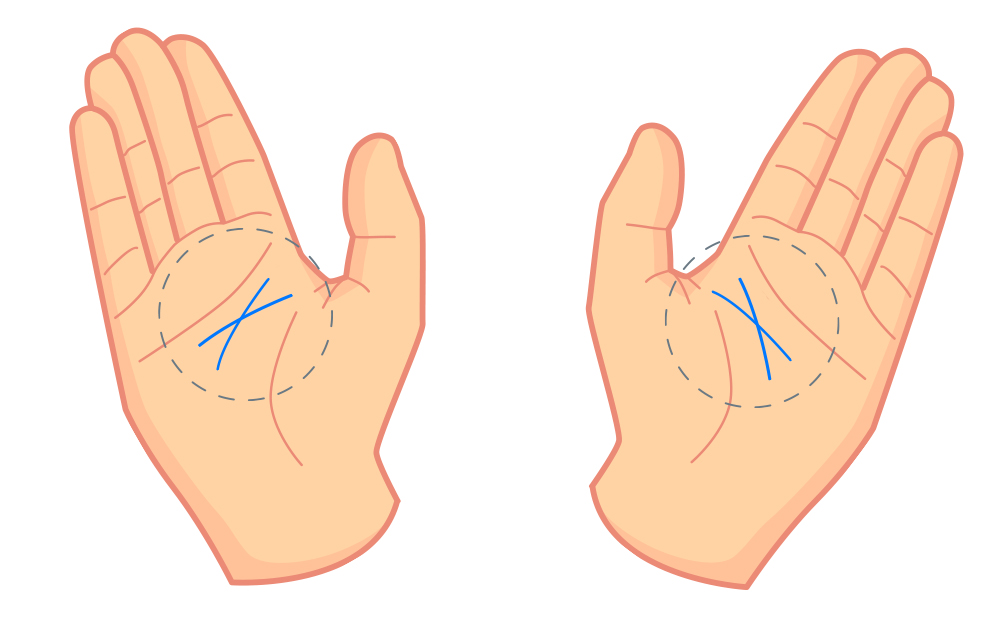 Imate li znak X na dlanovima? Saznajte što to znači! - CentarZdravlja