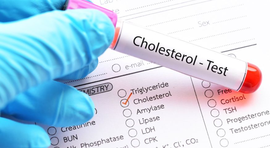 Kolesterol u krvi: idealne i povišene vrijednosti, posljedice i ...